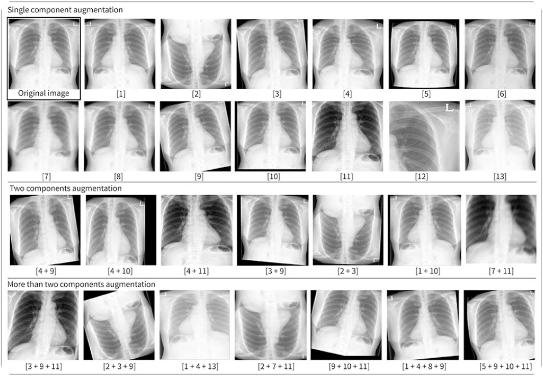 Using Albumentations augmentations to diversify your data